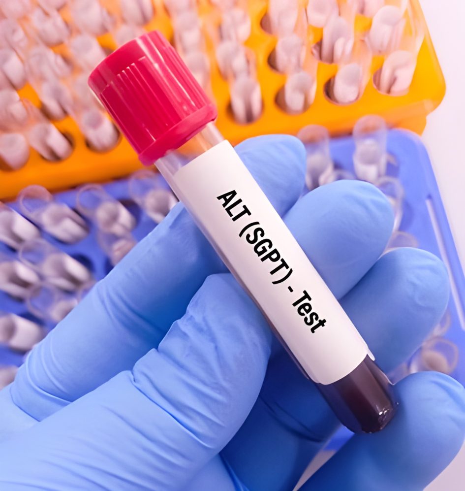 Normal ALT/SGPT Levels Chart for Male and Female: Age-Specific Reference Ranges
